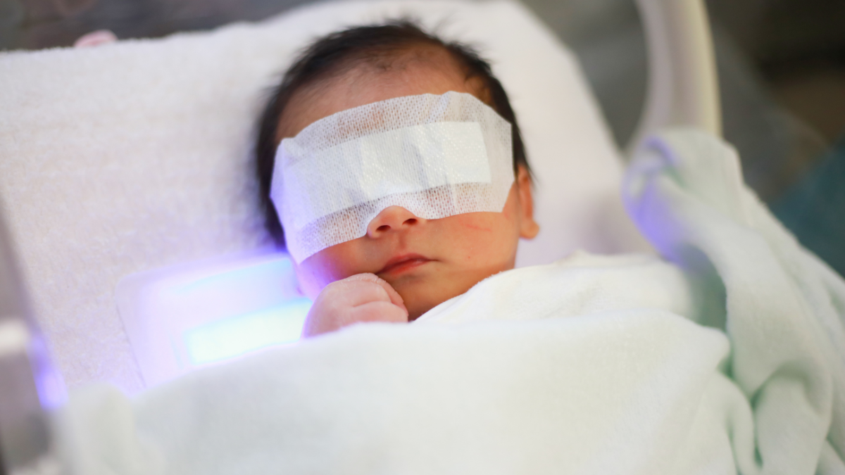 Jaundice Unraveled: A Must-Know Guide for New Parents - Dr Parents