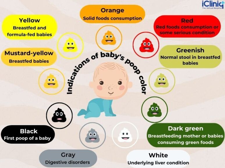 Know What Your Baby's Poop Means: Baby Poop Guide 101 - Dr Parents